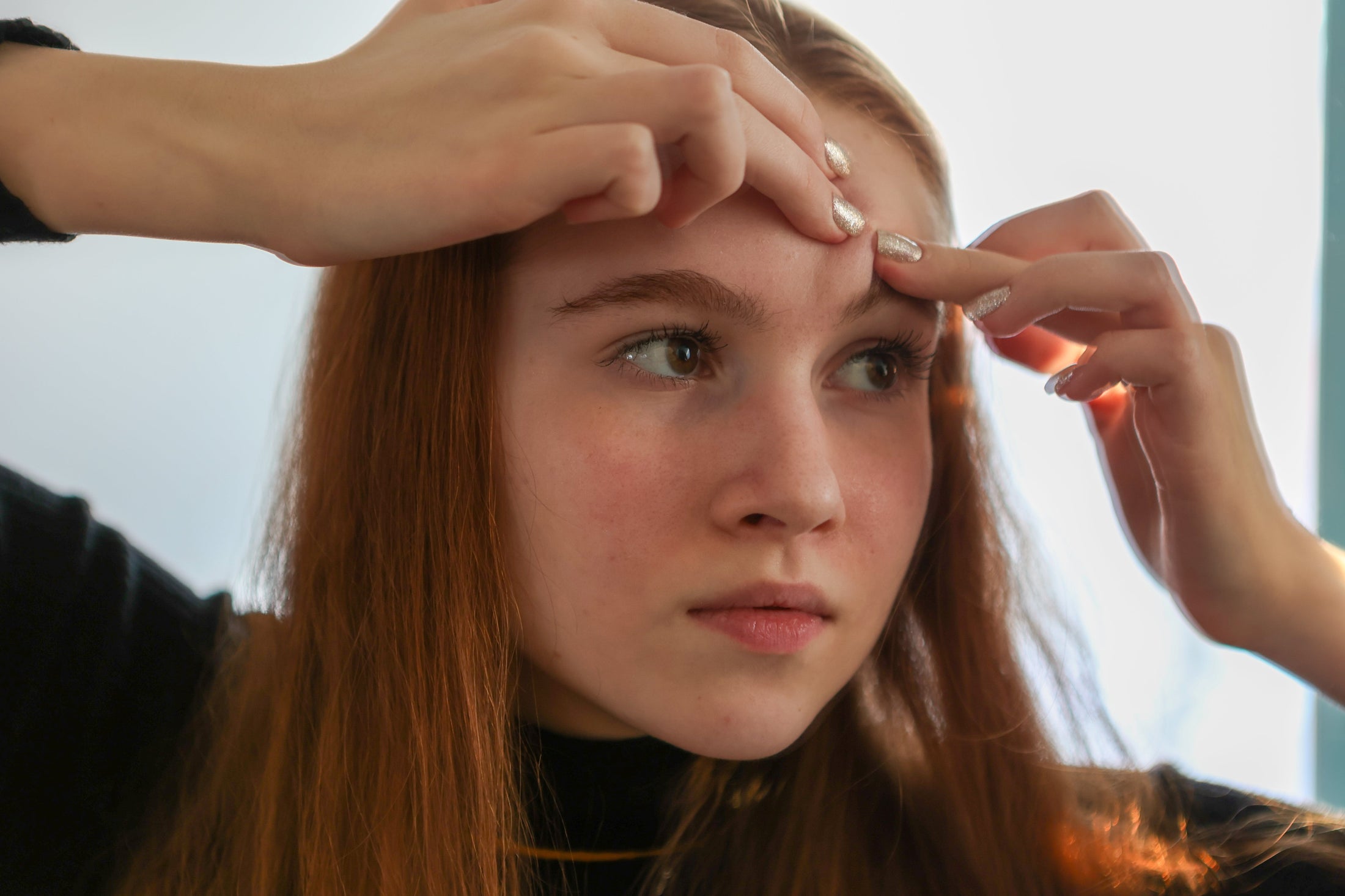 Chemical Peels for Acne: Benefits, Types, and Aftercare Tips – RePare ...